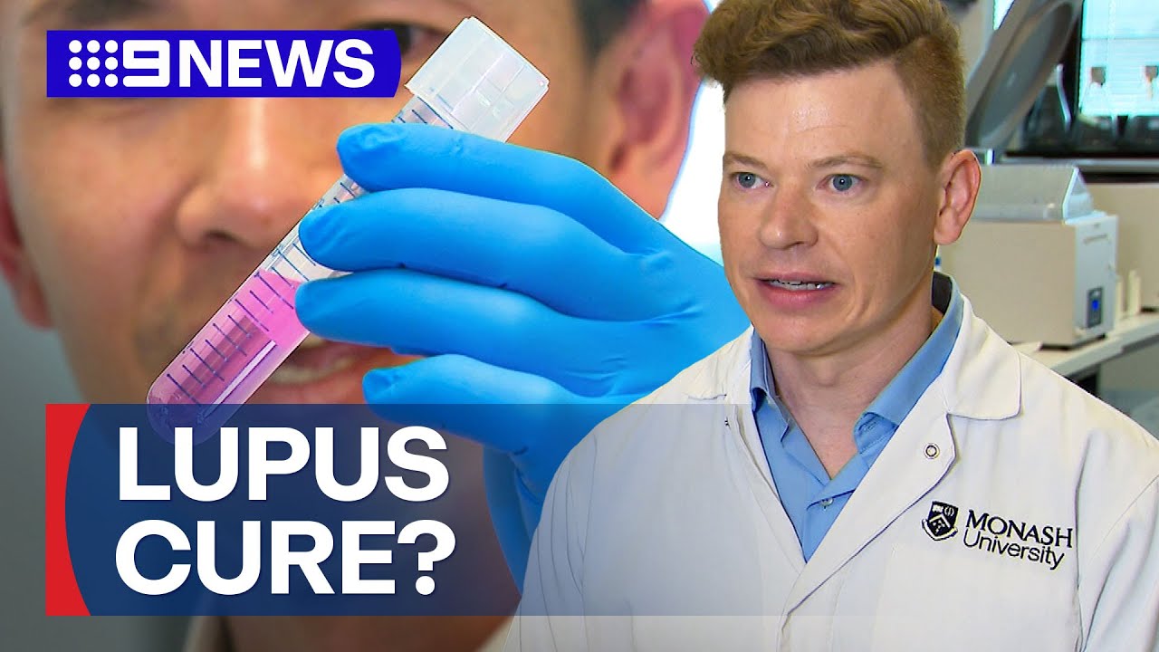 Australian Researchers Find Potential Lupus Cure